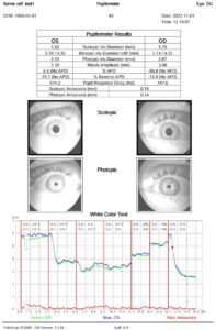 Virtual Reality Visual Field Analyzer | MMD Virtual Visual Field