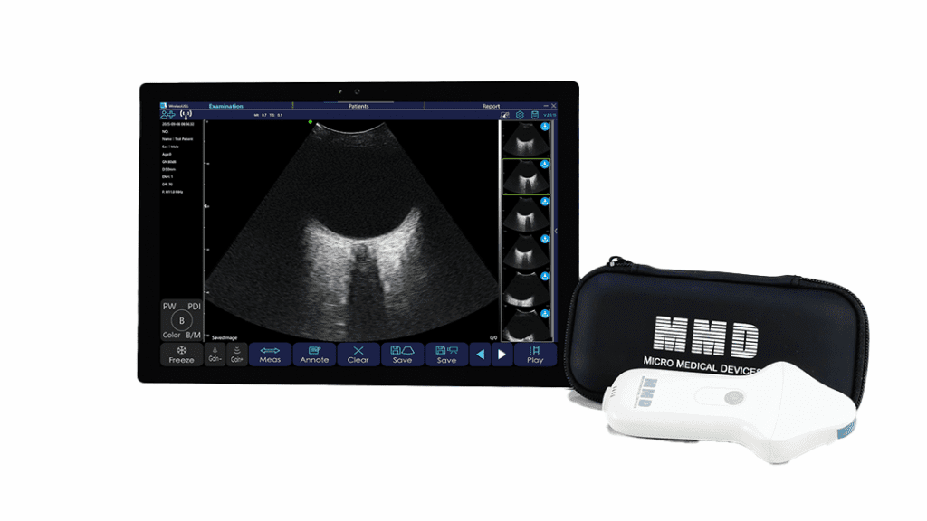 Portable Ultrasound Biometry Devices | Micro Medical Devices